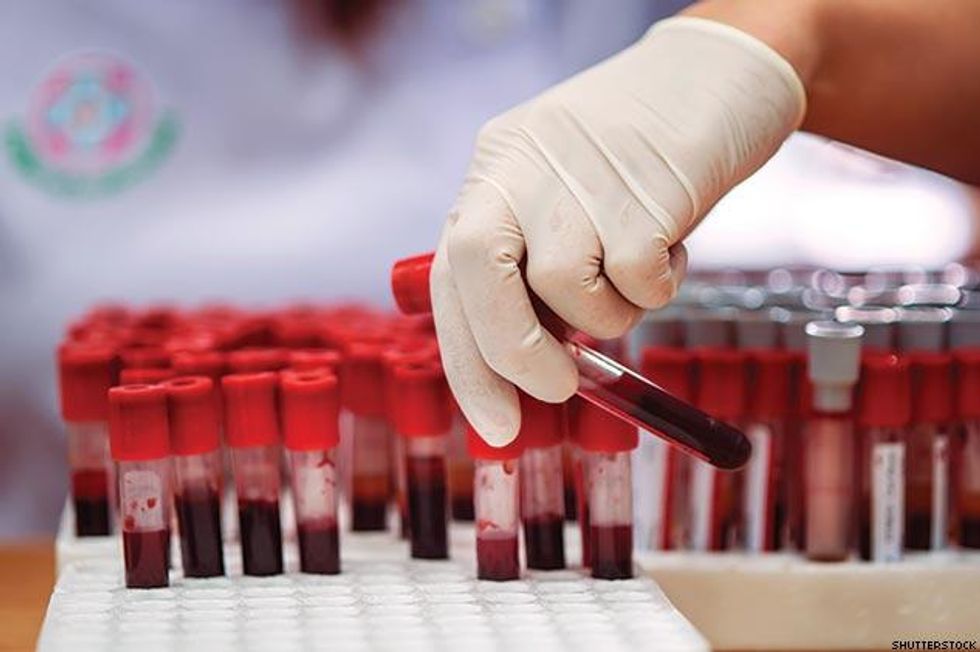 Just Diagnosed? Here's How to Understand All Those New Lab Tests