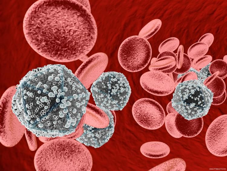 You Might Have Less HIV In Your Body Than Your Doctors Think